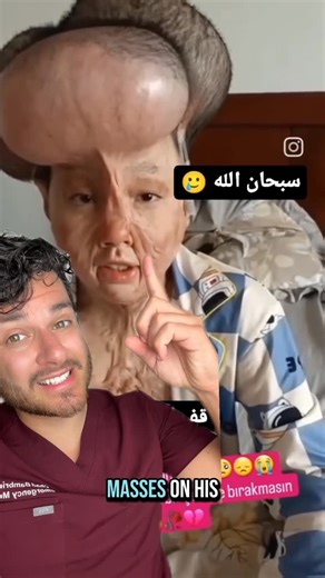 Dr. Chad on Instagram: "Balloon tissue expanders are a cornerstone of modern reconstructive surgery, particularly when preparing skin for grafting or flap coverage. These devices are placed beneath the skin and gradually filled with saline over weeks to months. As the balloon expands, it stimulates the body to generate additional skin that closely matches the surrounding area in color, texture, and thickness—making it ideal for definitive reconstruction. Common clinical uses include: • Burn reco