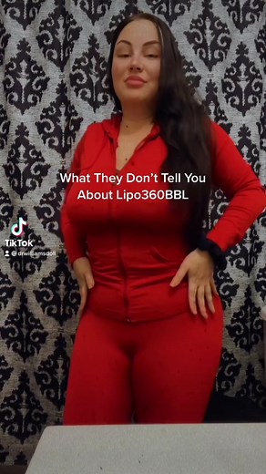 What They Don’t Tell You 🤫#bbljourney #bblrecovery #2weekspostop #lipo360bbl #bblbeforeandafter #305plasticsurgery