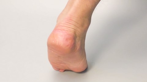 BEZOX Foot File (1 PCS), Double Sided Foot Scraper Callus Remover, Foot Rasp for Cracked Heel and Foot Corn Removal, Stainless Steel Pedicure File W/Cloth Storage Bag