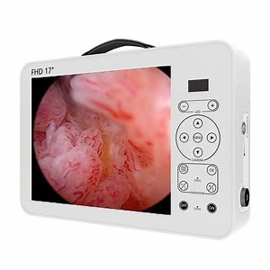 [Hot Item] High Quality Ent Camera Medical Monitor for Endoscopy