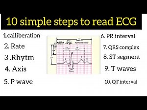 HOW TO READ ECG |ECG BASICS | ECG| EKG
