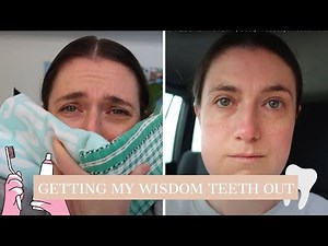🌈 MY WISDOM TOOTH REMOVAL AND RECOVERY STORY | Cost, Process, Infection and Swelling | CARLY MORTON