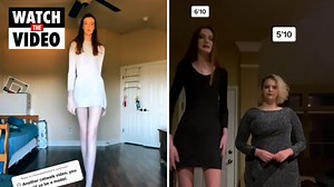 Teen with world’s longest legs stuns