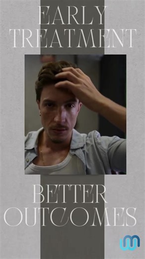 Thinning? Receding? Shedding? The earlier you act, the better the results. Speak to us today. #HairLossSupport #hairtransplant #finasteride #regain #hairloss #malepatternbaldness #minoxidil #propecia #ThinningHairHelp #HairLossJourney #HairCareTips #HairGrowth #BaldingSolutions