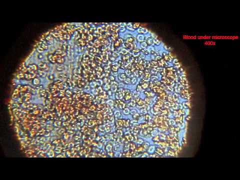 Under the Microscope: Blood [40x 100x 400x]