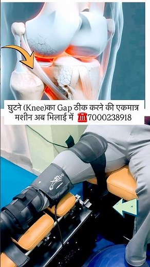 Knee Osteoarthritis || Knee Valgum Varus Deformity || Advance Robotic Knee Decompression Treatment
