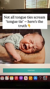 Sometimes it’s clear as day  (like this tight frenulum). But here’s...