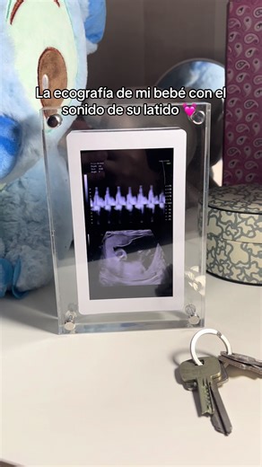 Cuadro de Ecografía: Recuerdo Familiar Emocionante