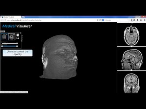 MedicalVisualizer web application by Mhmoudko [DICOM Viewer]