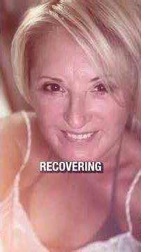 Terri's Deep Plane Facelift - Story Time! #deepplanefacelift #plasticsurgery #facelift