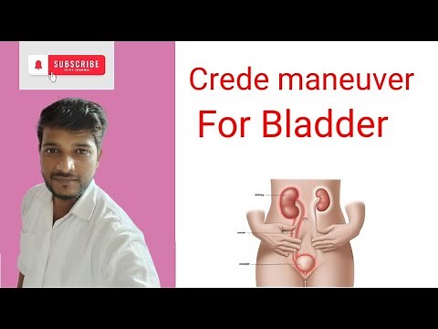 crede maneuver|| crede maneuver for bladder