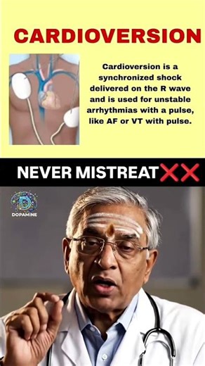 Cardioversion vs Defibrillation🔥🔥🔥