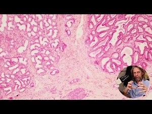 Histology of the prostate and seminal vesicles
