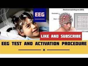 HOW TO PLACED EEG ELECTRODES AND ACTIVATION PROCEDURES #eeg #ncs #neurology #neurotech #emg