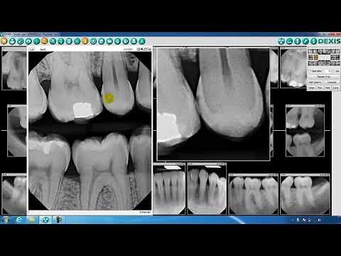 DEXIS™ Imaging Suite Toolbar Overview - Part Two