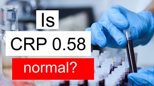 Is CRP 0.58 normal, high or low? What does C Reactive Protein level 0.58 mean?