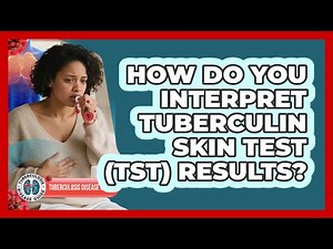 How Do You Interpret Tuberculin Skin Test (TST) Results? - Tuberculosis Disease Guide