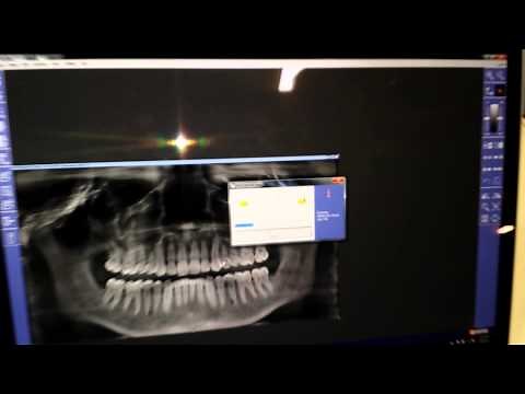 How to export DICOM data from a Sirona CBCT (Sidexis, Galileos, Dolphin software)