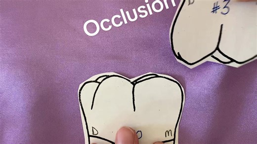 occlusion Key Concepts #study #hygieneschool #studyhacks #studynotes #dental