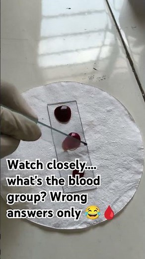 Blood grouping practical/ step by step blood grouping demo🩸#bloodgrouping #practical exam lab demo