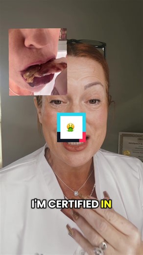 Certified Teeth Whitening with Dr Dent's Purple Formula