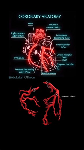 🚩🫀 Coronary Anatomy: ✅ Repost Explore this detailed diagram of the coronary arteries - Left Main Coronary Artery (LMCA) - Left Anterior Descending (LAD) Artery - Circumflex (Cx) Artery - Diagonal (D1, D2) Arteries - Obtuse Marginal (OM1, OM2) Arteries - Septal (S1, S2) Branches. #Cardiology #HeartHealth #MedicalEducation #CoronaryArteries #Anatomy #HeartAnatomy #CardiovascularHealth #MedicalStudents | Abdallah Othman