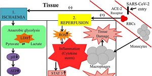 THE SPIKE PROTEIN’S EFFECT ON THE MICROVASCULATURE OF THE HEART AND OTHER ORGANS IS EQUIVALENT TO A SILENT “HEART ATTACK.” ADDITIONAL DAMAGE FROM ISCHEMIA-REPERFUSION INJURY.