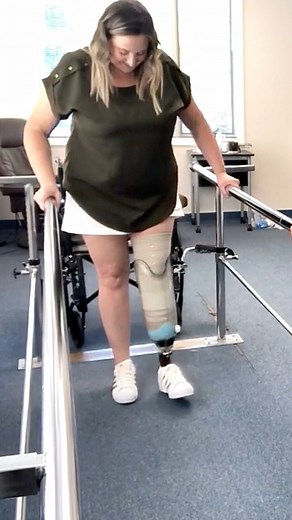 Does walking in a prosthetic leg hurt? If your prosthesis is hurting you, you need it adjusted. Go back to your prosthetist. If they won’t help you, find someone who will. There are many different types of prosthesis and hopefully they can find one that helps you walk comfortably. 🌍 I’m an amputee traveling the world — sharing real-life adaptive accessible travel tips, prosthetic hacks abroad, and smart problem-solving hacks for navigating life on the move. ✈️ From airport chaos to terrain chal