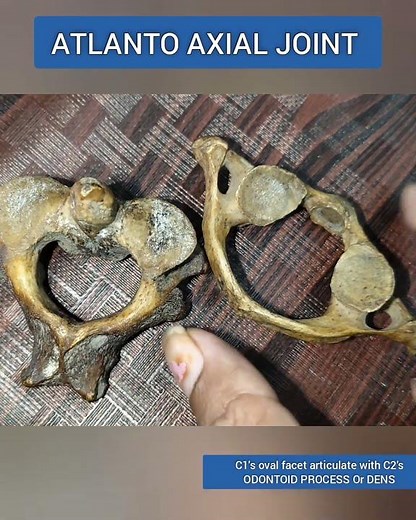 atlanto axial joint, a quick recap #anatomylecture #anatomy