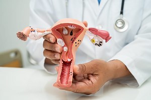Endometriosis: 10 Signs You Shouldn’t Ignore and When to See a Doctor