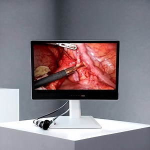 [Hot Item] 4-in-1 Endoscope Camera with Integrated Display for Surgical Use