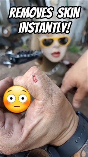 It's an easy way to remove it!