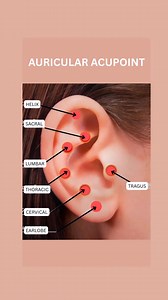 14K views · 117 reactions | Ear Acupuncture offers various benefits, including: – Pain Management : Alleviates headaches, migraines, and muscle tension. Stress Reduction, Promotes relaxation#acupuncture #acupressure #reels #auricularacupoints #acupuncturistaadilkhan | Aadil Khan | Facebook