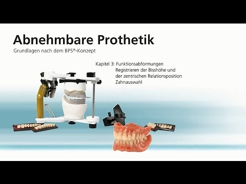 Abnehmbare Totalprothetik – Kapitel 3