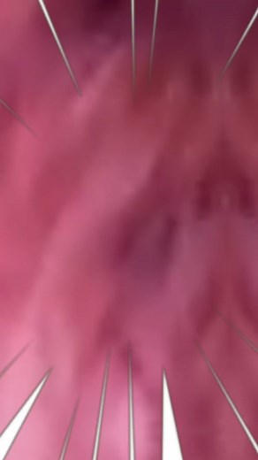 El Mejor Supp con Vex: Guía Completa para League of Legends