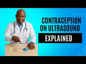 Contraception Explained