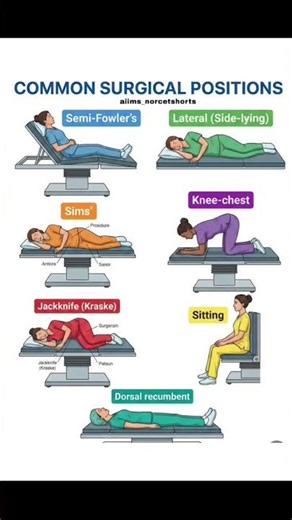 Common Surgical Positions | Supine, Prone, Lithotomy, Trendelenburg #nursing #viral #youtubeshorts
