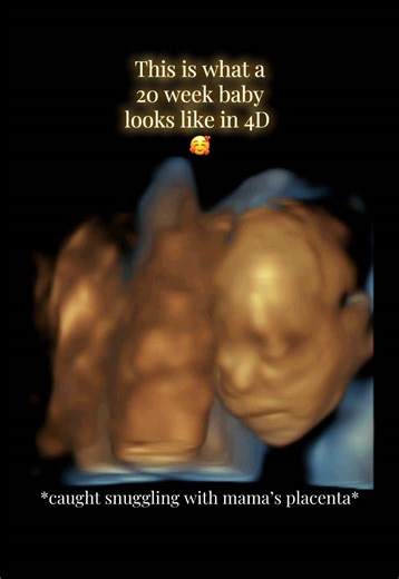 First cameo, tiny toes, main-character profile 😌👶 4D magic hits different ✨ #4DUltrasound #MobileUltrasound #TinyToes #PregnancyMagic #RadiantMoments