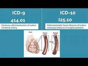 Top 20 Cardiology ICD-9 to ICD-10 Codes