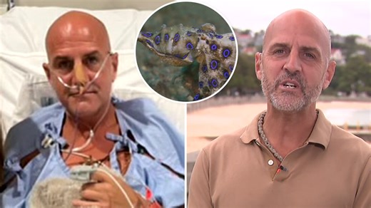 Man recounts moment blue-ringed octopus bit him