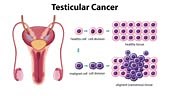 Animation de la division cellulaire du cancer du testicule
