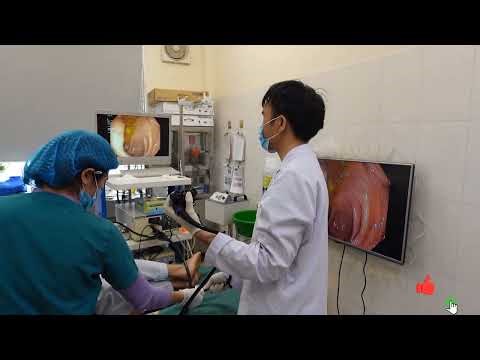 Nội soi đại tràng dễ như thế này sao?