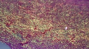 clip-3395956241-section-human-artery-magnified-under-microscope-100x