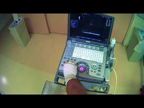 7 Adjusting Ultrasound Machine Settings