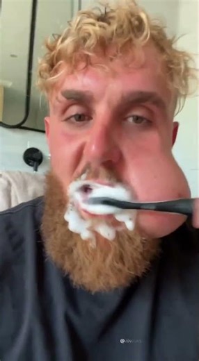 jake paul morning routine with swollen jaw 😳🧊