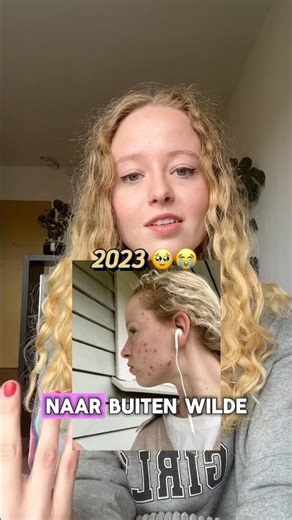 Over skinpicking disorder…