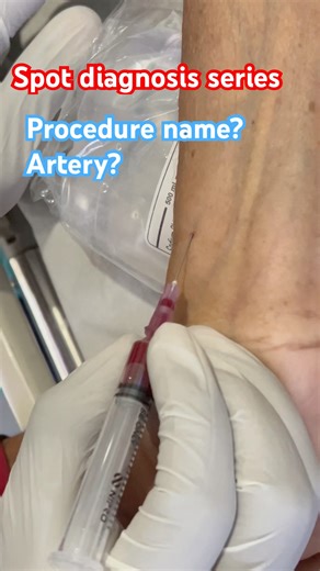 Spot diagnosis series #ytshorts #shortvideo #mbbs