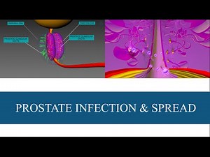 Microbes in the Prostate | Prostatitis & STIs