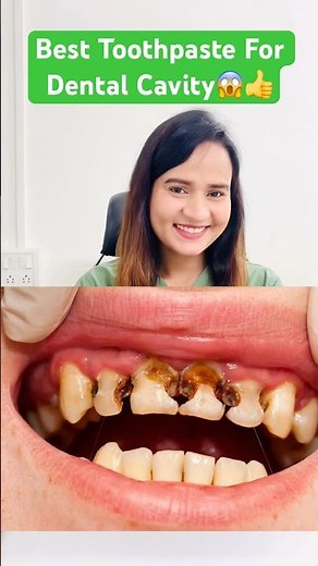 Best Toothpastes For Dental Cavity | #doctorrajni #dentalcaretips #toothpaste #dentalcavity #shorts