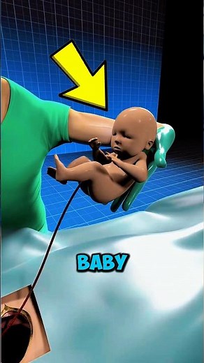 C Section Procedure Explained #csection #childbirtheducation #cesareandelivery